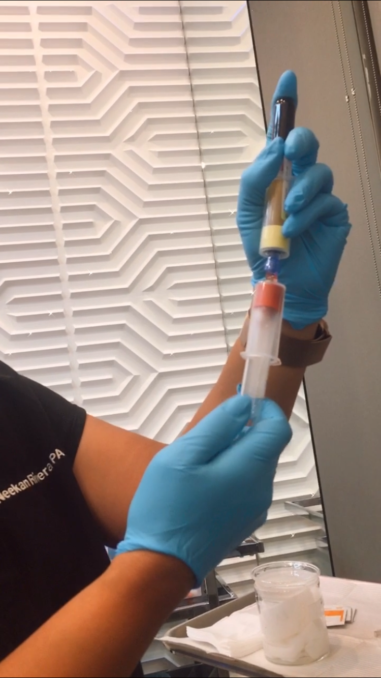 Microneedling with PRP vs. PRF - Which One is Better?